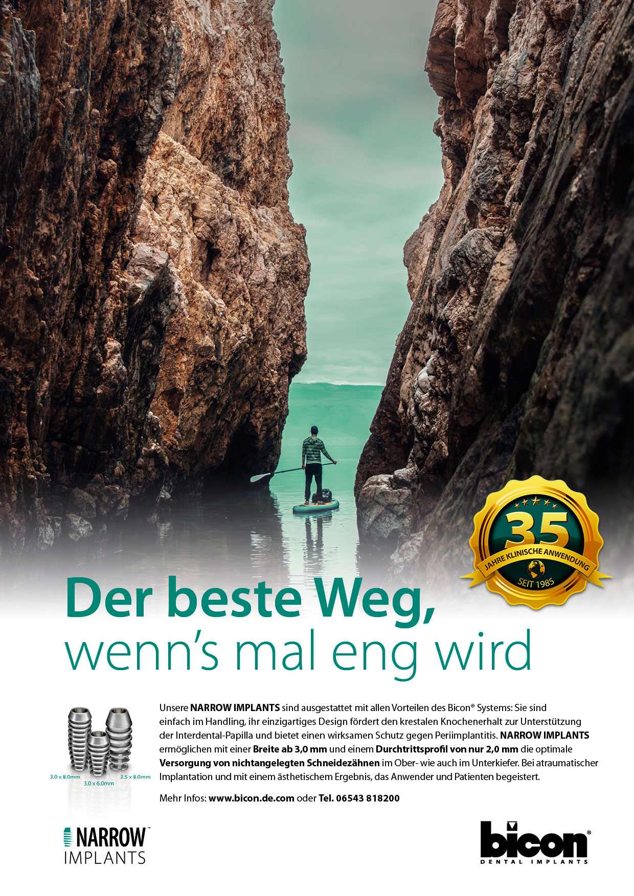Bicon Narrow Implants Fachanzeige | Reinhold Janowitz Creative Direction